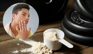 Can Creatine Really Cause Acne? What Does Science Say - Hills County Health